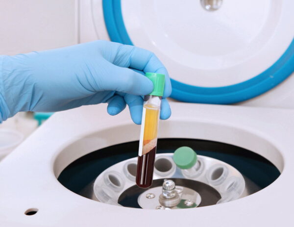 Leading PRP Therapy & Regenerative Medical Solutions | Juventix